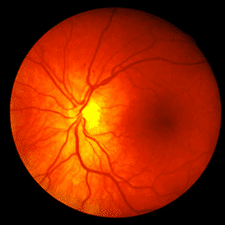 Фотографія очного дна - Медичний центр Oculus